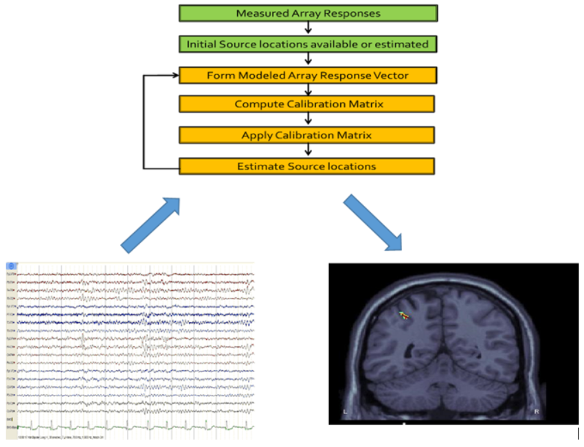 Cortical Source Imaging Using Eeg American University Of Sharjah